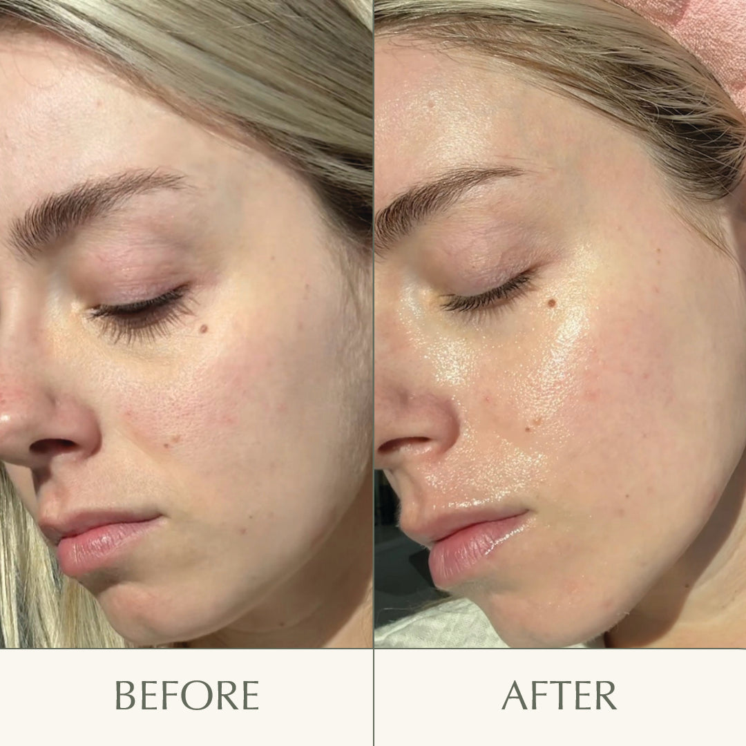 Dassai Facial Mask - Sake Infused Hydration - Shikō Beauty